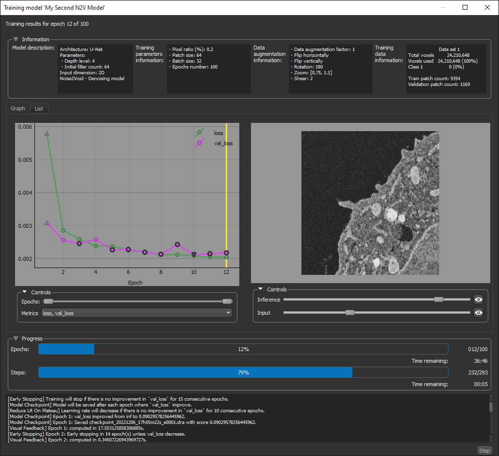 Training Noise2Void Models