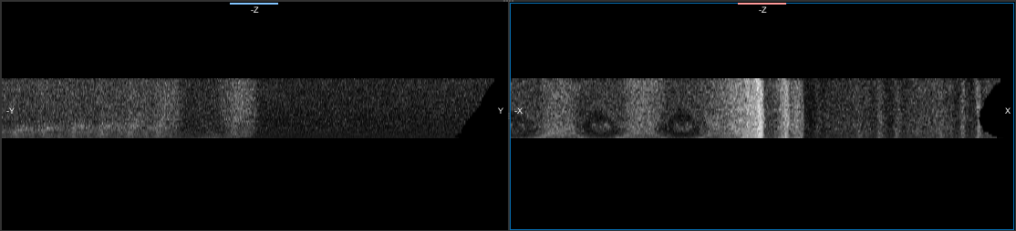 Aligning Slices Automatically